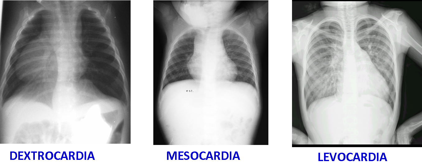 Cardiólogo Pediatra Dr. Josué Cauich Segovia Star Médica Mérida ...