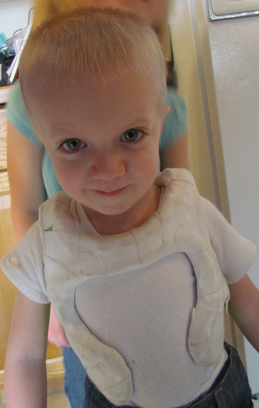 Our Journey through Progressive Infantile Scoliosis: Finally...Pictures ...