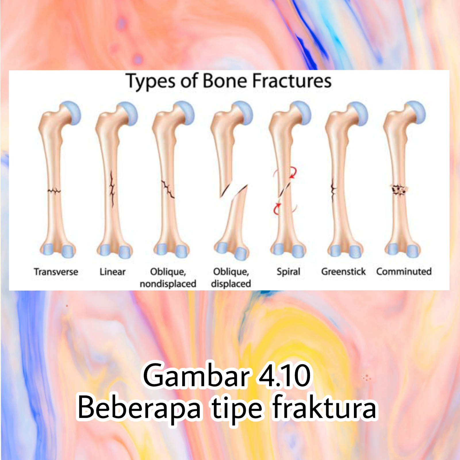 Penjelasan Materi Gambar Bab 1 Sistem Gerak
