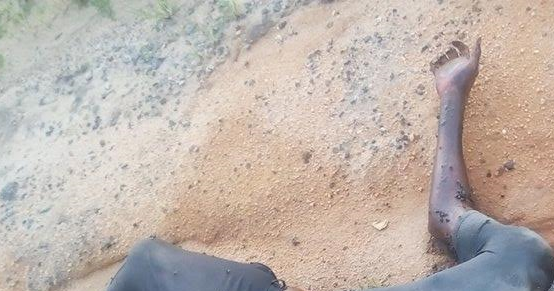 Photo: Decomposing body of a man with matchet cuts lying under Goodluck ...