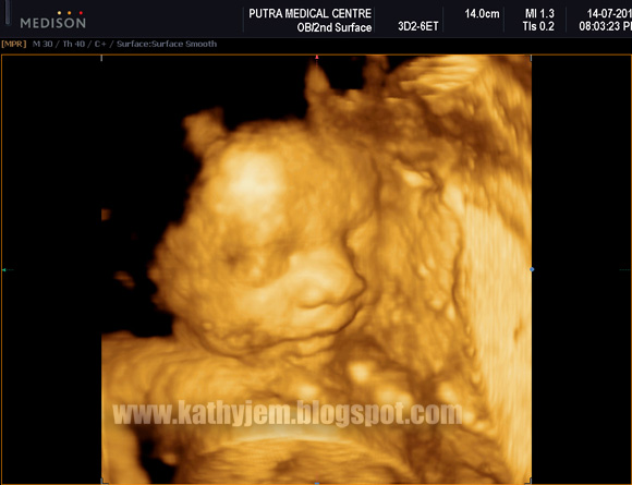 kathyjem: Wajah Baby Ketika Scan 4D..
