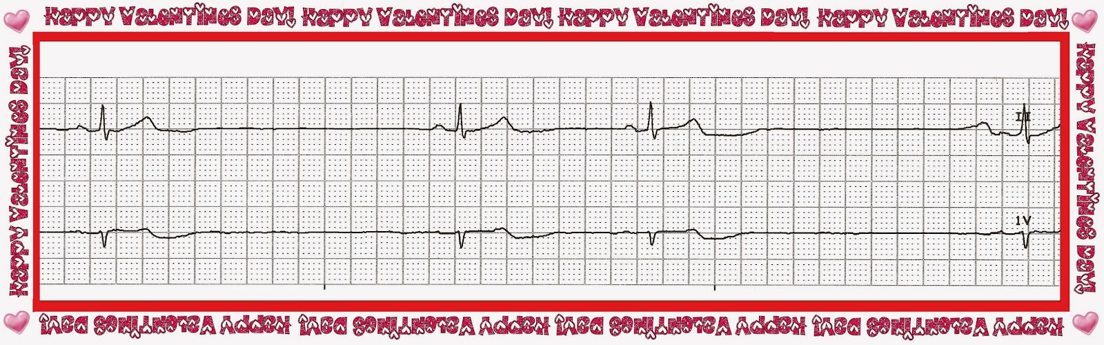 Practice EKG Strips (Valentine's Day)