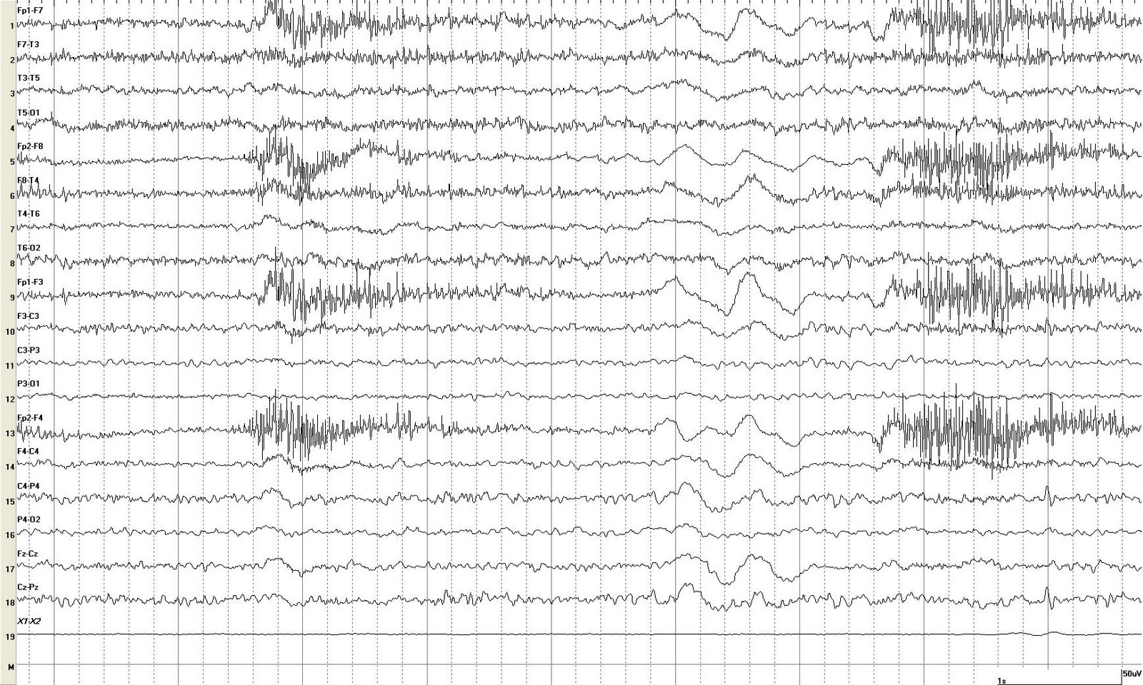 EEG Reviewer: EEG No. 37