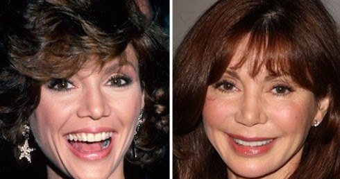 Chatter Busy: Victoria Principal Plastic Surgery