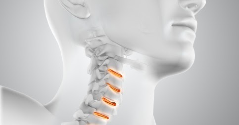 Prevenzione e Salute: Cervicale: Quai sono el cause e come combatterla