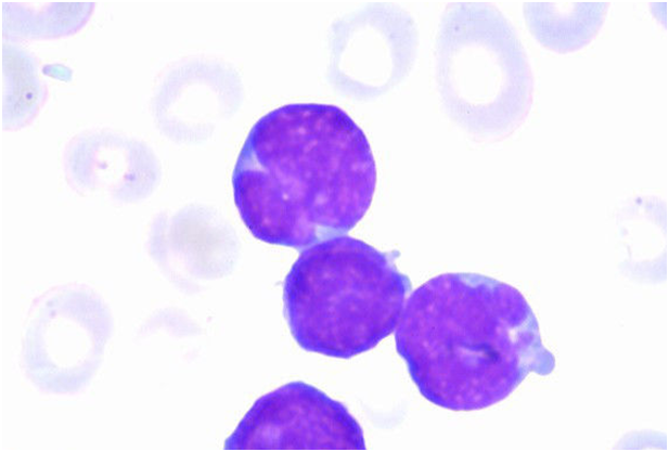 Hematologia Clínica : Atlas de Hematologia