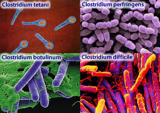 CLOSTRIDIUM