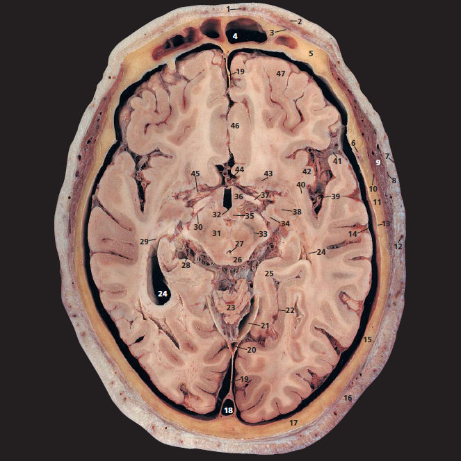 Head sectional anatomy