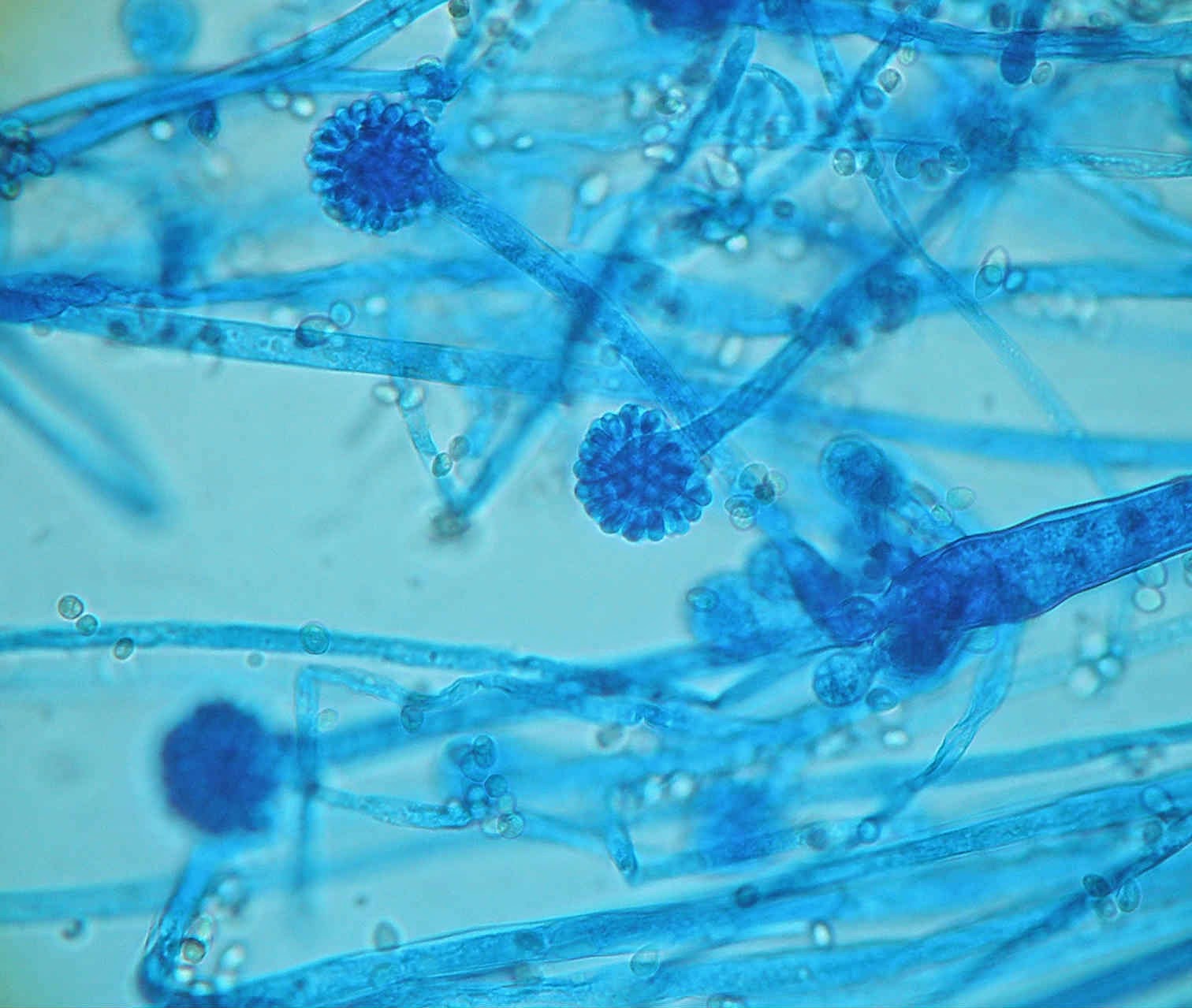 ATLAS MICOLOGIA: CUNNINGHAMELLA BERTHOLLETIAE