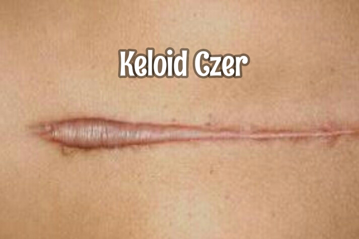 faizahfyninnerbeauty: December 2018