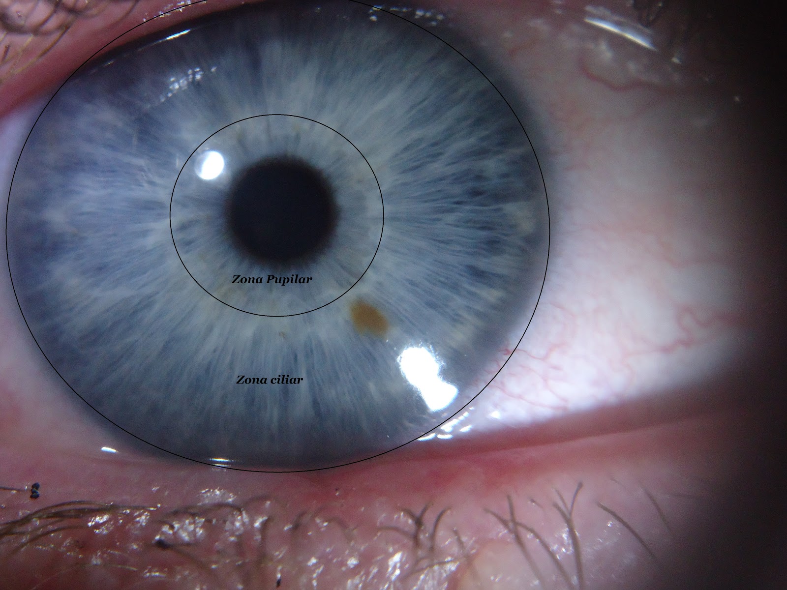 O Que é A Iris Do Olho - FDPLEARN