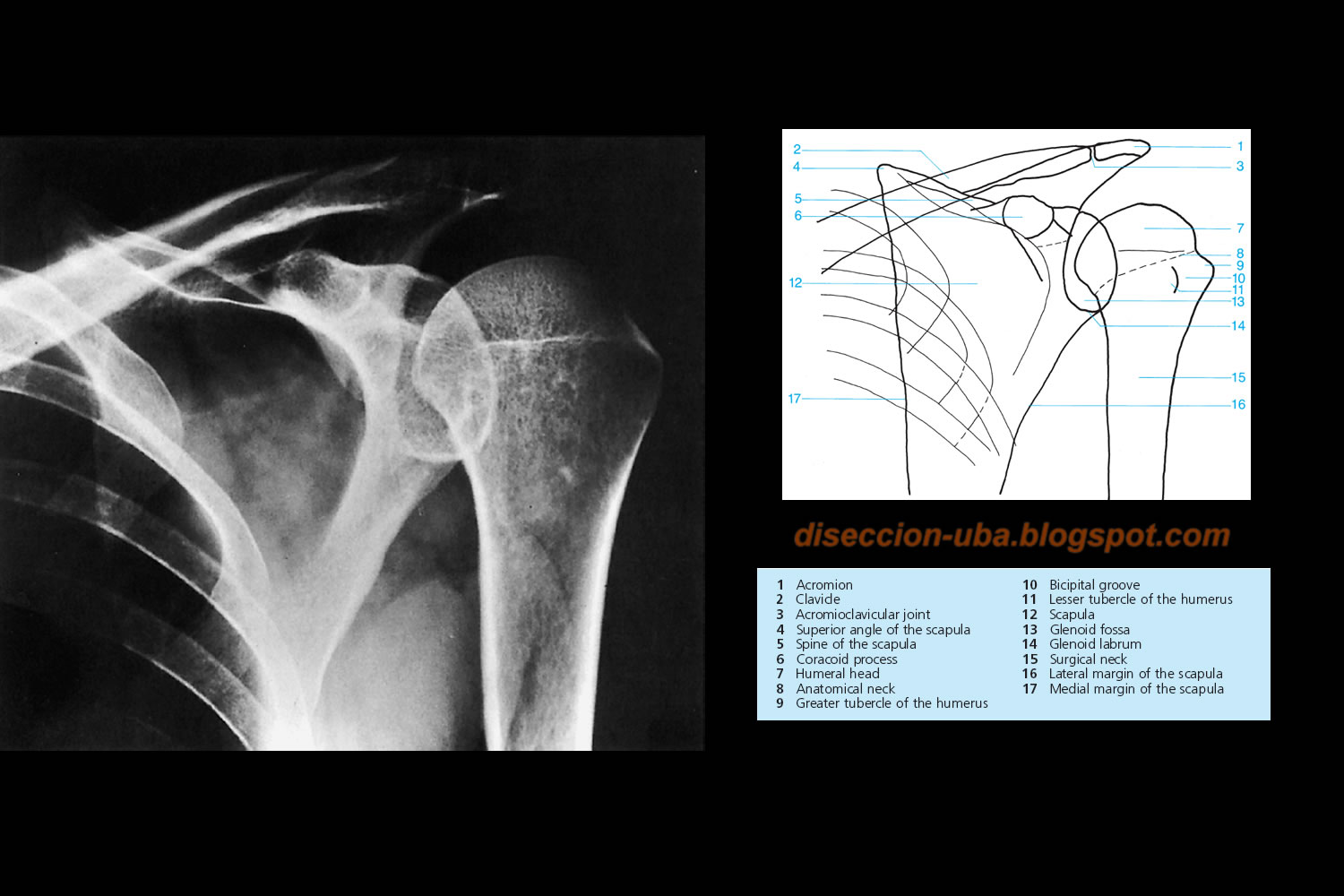rx: Rx hombro en posición anatómica