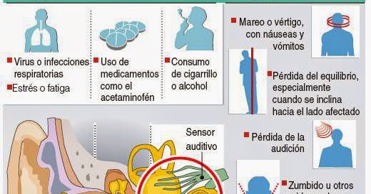 La Parafarmacia de Miren: la Laberintitis