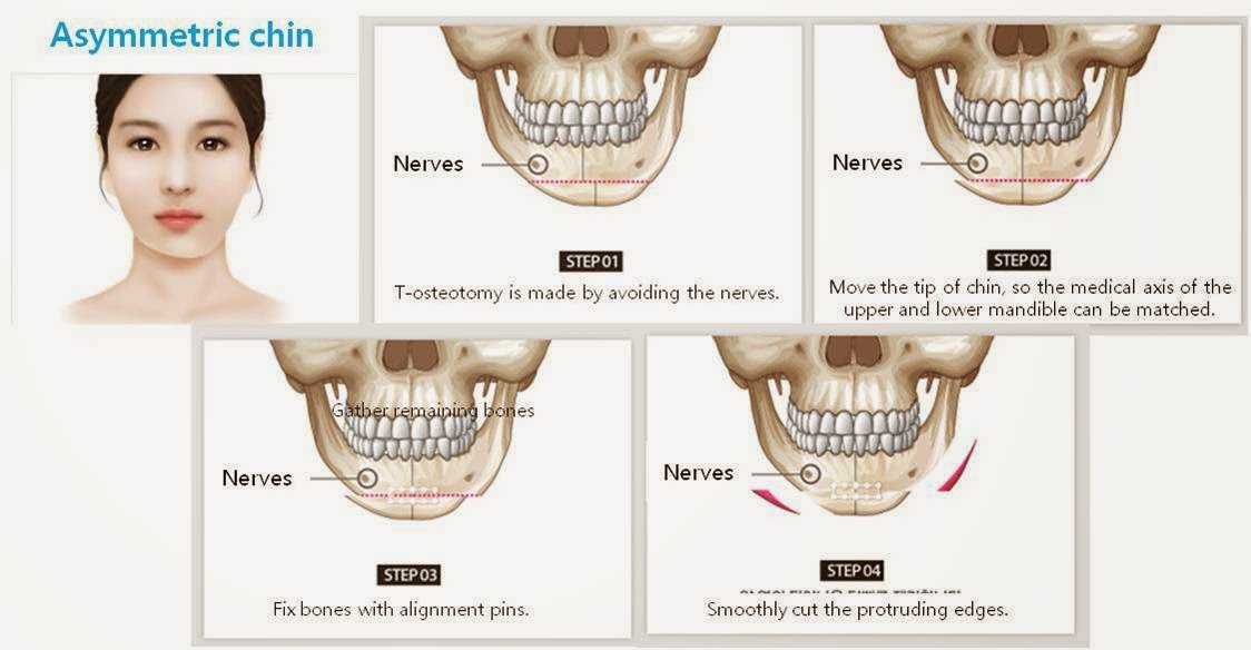 ID Hospital Korea: September 2014