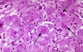 My Gastro Room: September 2012