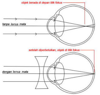 anatomi fisiologi: paper anfis sistem penglihatan