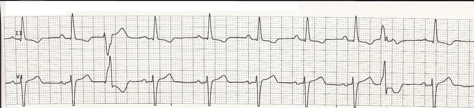 EKG Rhythm Strip Quiz 1
