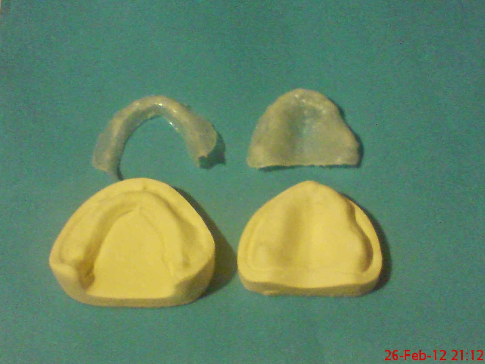 Dental Sparkling: Elaboración De Cucharillas Para Prostodoncias Totales.