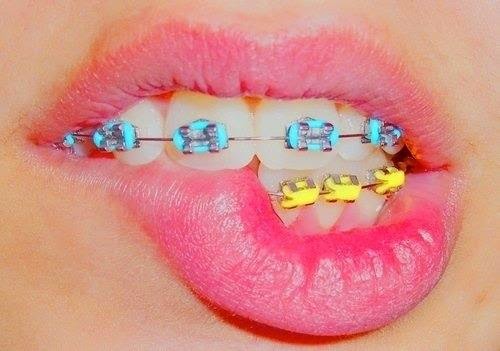 Brackets