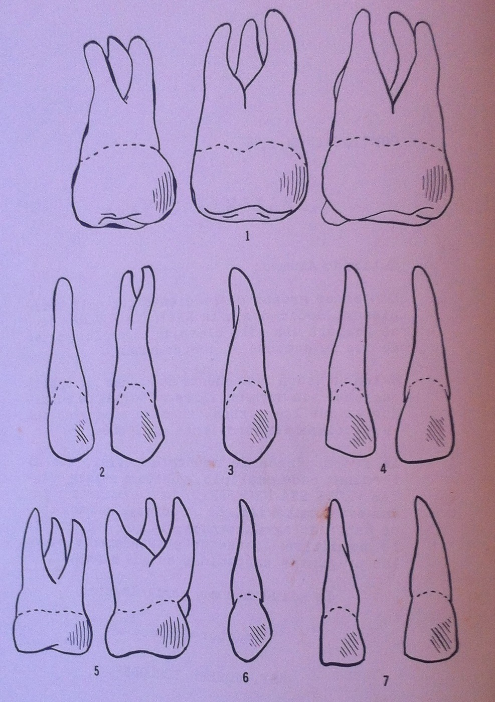 ANATOMIA DENTAL ~ Cursos de Enfermeria