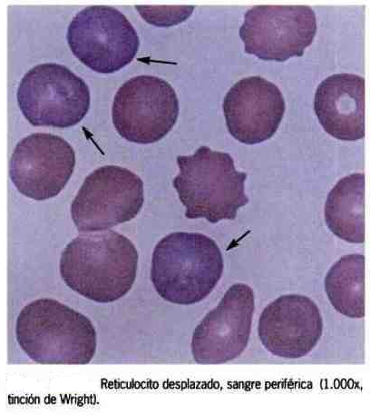 Laboratorio Clínico: Morfología normal de los eritrocitos.