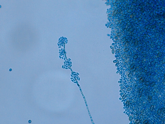 Fun With Microbiology (What's Buggin' You?): Exophiala dermatitidis