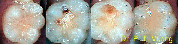 Dr. Phuoc Vuong Dentist - Phuoc T. Vuong, DMD, MS - Dr. Phil T. Vuong ...