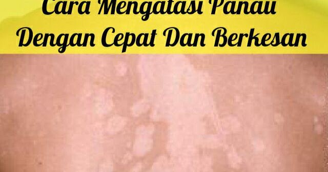 Cara Atasi Panau Dengan Cepat Dan Berkesan Elak Kembali Berulang
