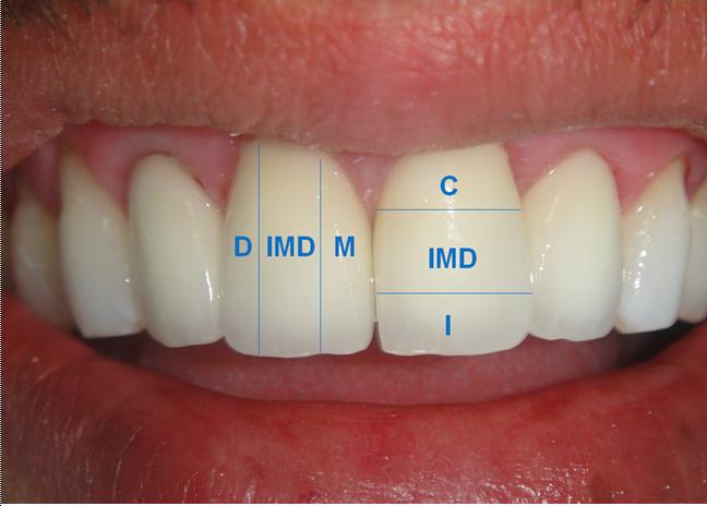 Um pouco de Odonto: Identificação das Faces dos Dentes e Estruturas ...