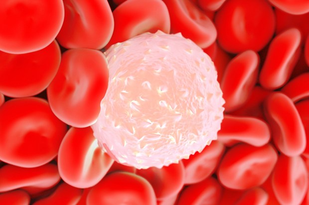 Pleocytosis ICD-10, Definition, Symptoms, Causes, Treatment, Diagnosis ...