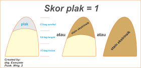 Fije dental blog: mengukur kebersihan gigi dan mulut