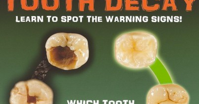 Dr. Linden Stevens: Norco CA Dentist, Dr. Linden Stevens Shares The ...