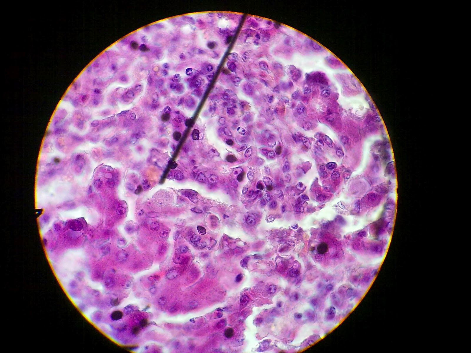 Sil 'Vet' Bullet: Histomonas meleagridis