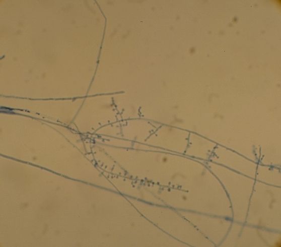 Microbiología y Epidemiología: Trichophyton rubrum. Trichophyton ...