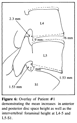 Absolute Health: Inversion therapy for back pain