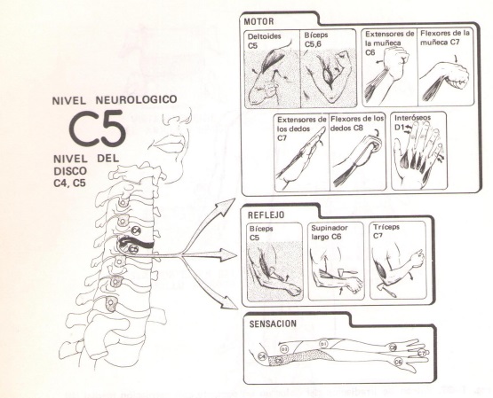 Neurologia2016: REPASO DE NIVEL NEUROLOGICO C5- D1