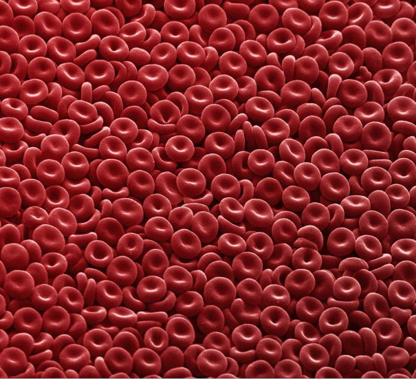 Information Through Images: Red Blood Cells under the Electron Microscope