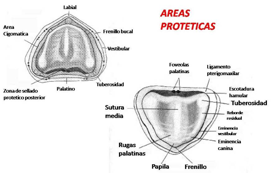 PROTESIS DENTAL : ZONAS PROTESICAS