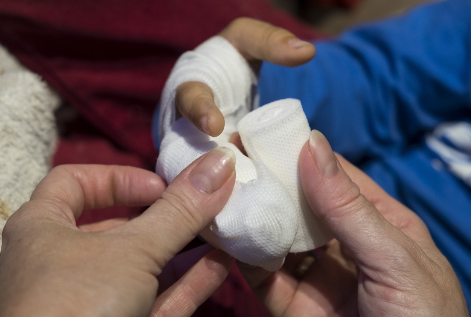 Mengetahui Macam-Macam Balutan Luka - Gerbang Media Online