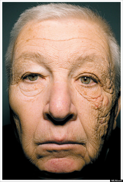Fleming Island Plastic Surgery: 25 years of sun damage in 1 picture
