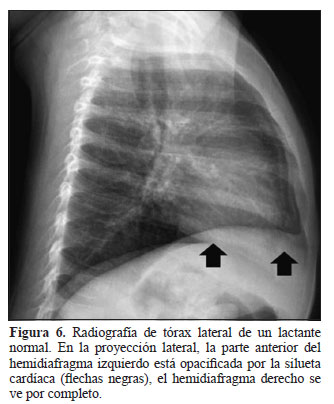 RADIOPAEDIA UDLA JUAN CARLOS JARA SANTAMARÍA 7mo: Rx Lateral