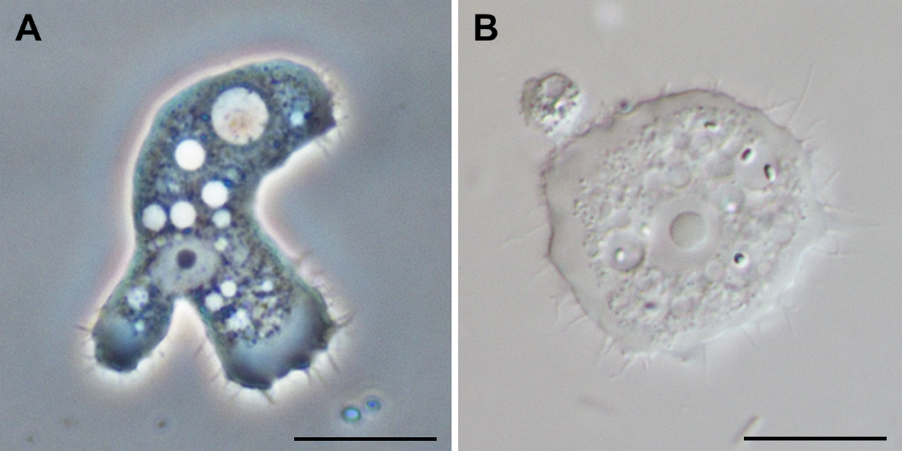 Parasite of the Day: Acanthamoeba spp.