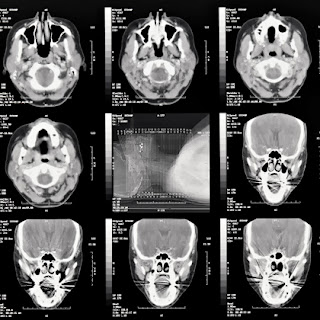 BLOG TUGAS ANDRI PEBRIAN: Perbedaan dan contoh grafik komputer dan ...