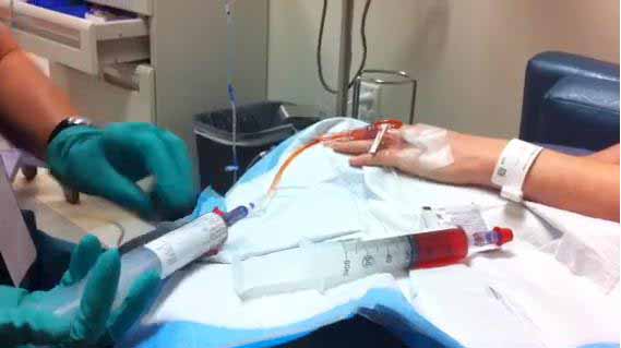 Breast Cancer at 38: AC Chemo