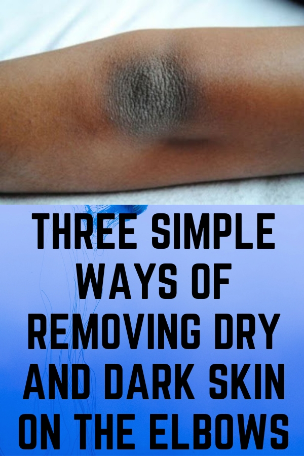 THREE SIMPLE WAYS OF REMOVING DRY AND DARK SKIN ON THE ELBOWS