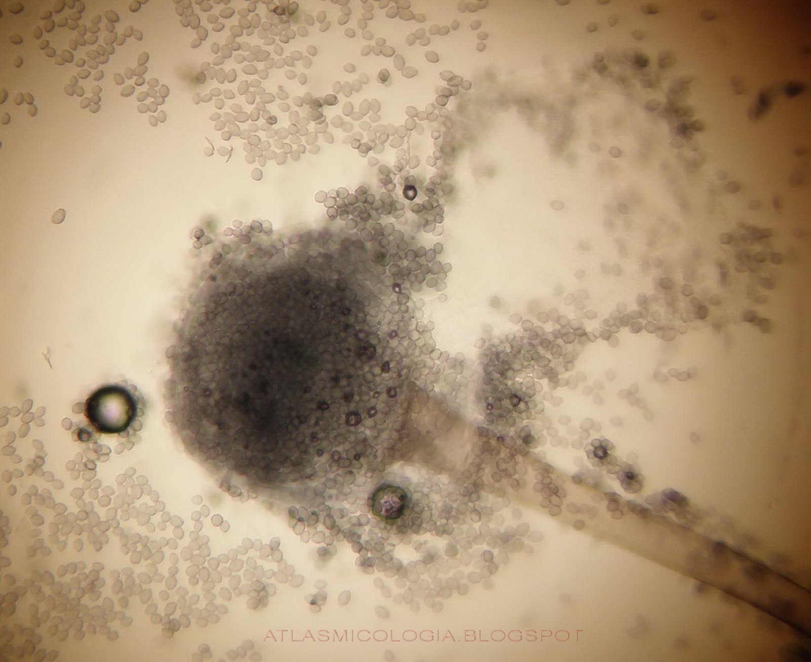 ATLAS MICOLOGIA: RHIZOPUS SP.