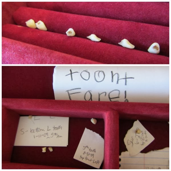 CONTROLLING Craziness: Baby Teeth - how to store them