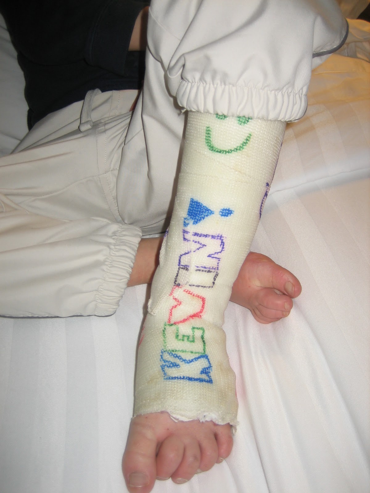 Kevin's Healing Journey: Left Foot Cast #2