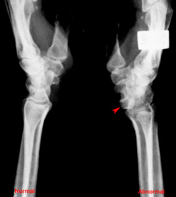 Bone Section: Lunate Dislocation