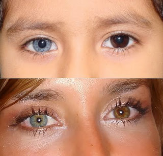 De tudo um pouco 7ºB : Heterocromia. O que é isso?